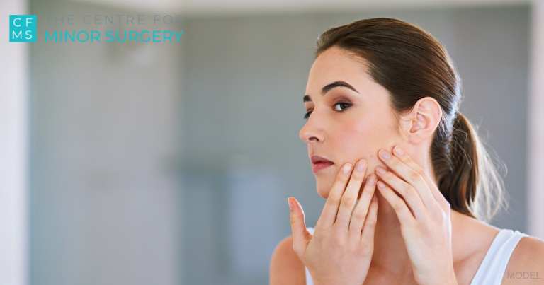 What Are the Different Types of Skin Cysts & Where Do They Occur ...